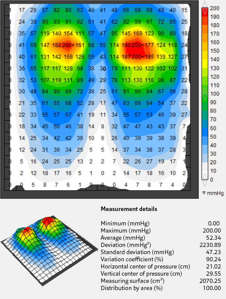How to choose the right pressure care mattress – Aesthetics Healthcare